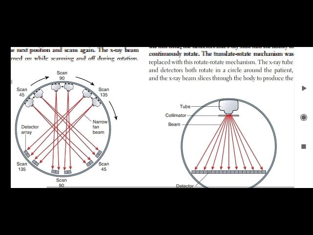 Understanding CT Scanner Generations: A Comprehensive Overview | Galaxy.ai