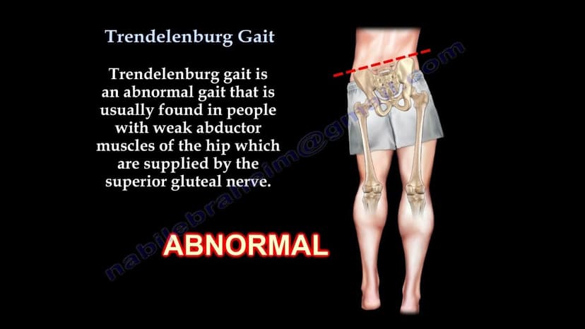 Understanding Trendelenburg Gait: Causes, Symptoms, and Implications ...
