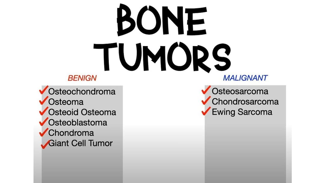 Understanding Bone Tumors: A Quick Guide to Benign and Malignant Types ...