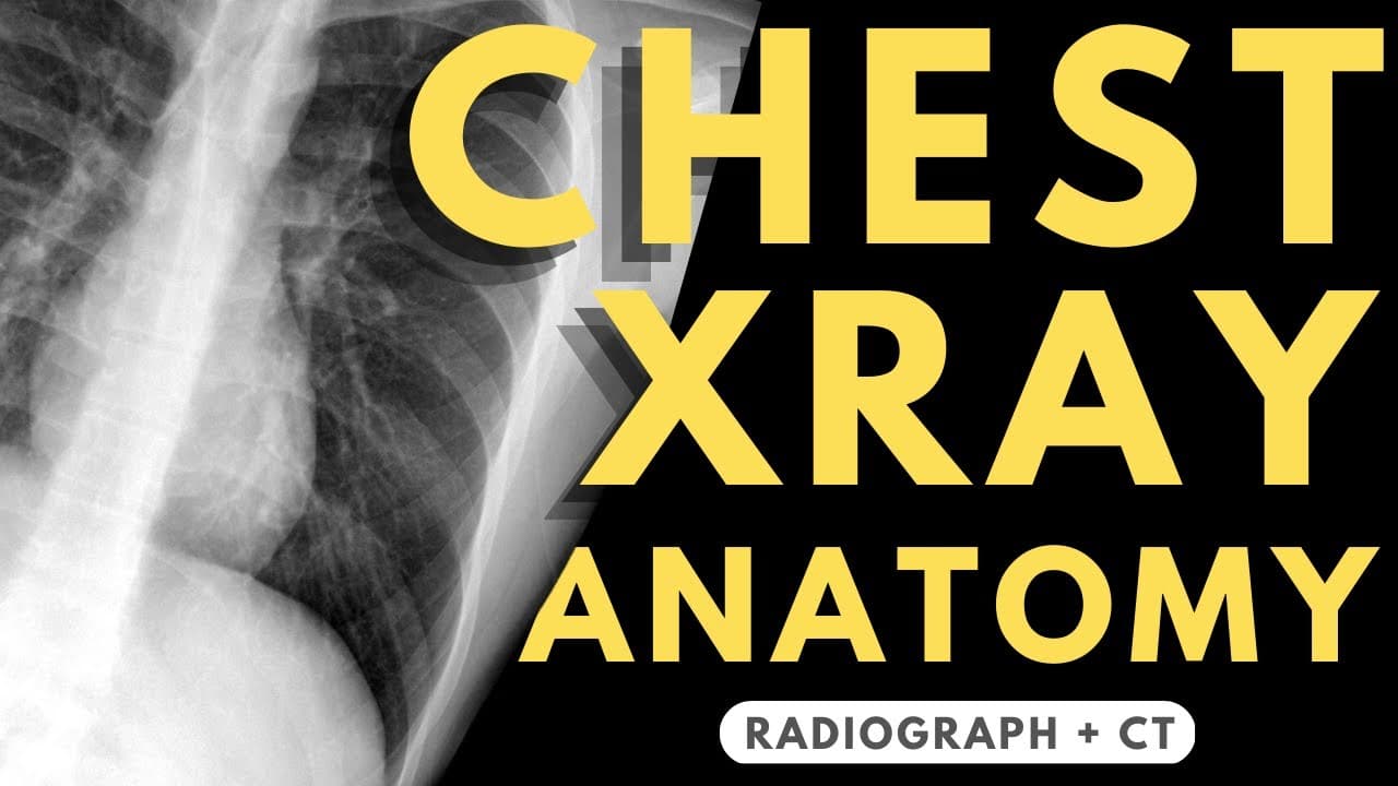 X Ray Chest Anatomy 60 Normal Chest Xray Stock Photos, High Res