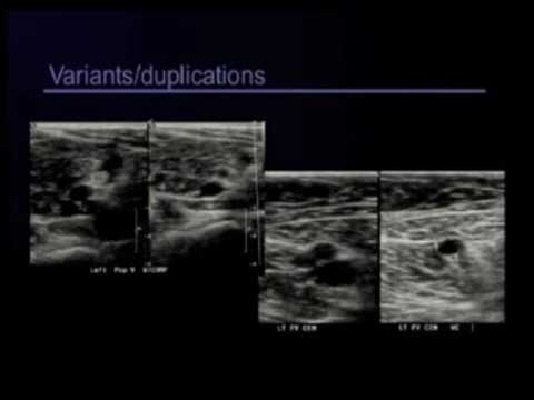 Understanding Lower Extremity Venous Doppler: A Comprehensive Guide to ...
